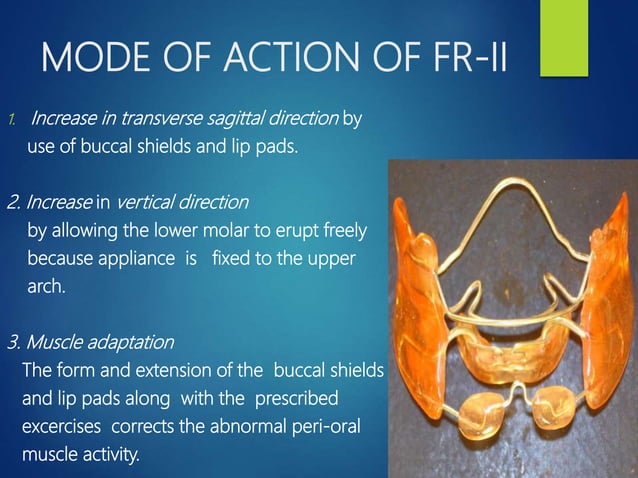 Myofunctional appliances | PPTX | Dental Health | Diseases and Conditions