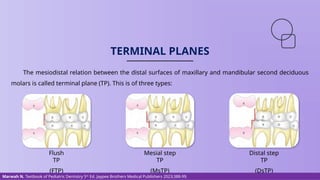 Myofunctional Appliances in Pediatric Dentistry | PPTX