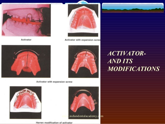 Myofunctional appliances