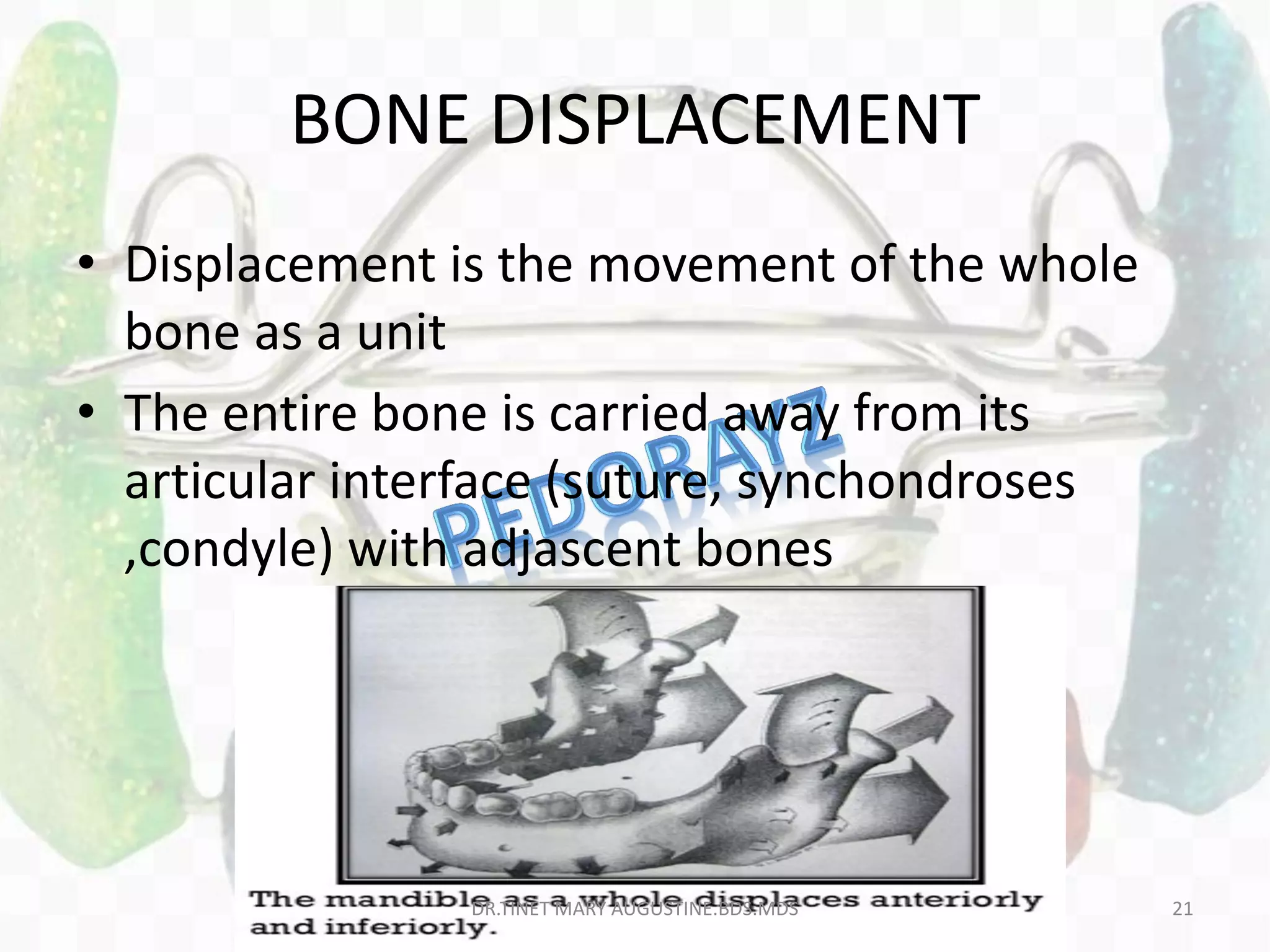 Myofunctional appliances -BASIC PRINCIPLES | PDF