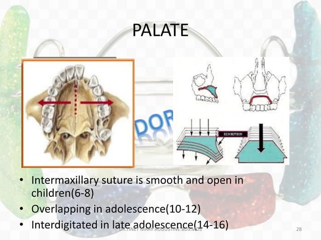 Myofunctional appliances -BASIC PRINCIPLES | PDF