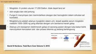 Myoglobinuria pada luka bakar listrik combustio | PPT