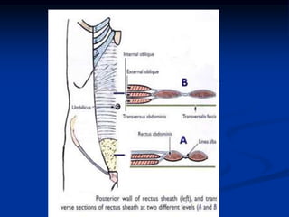 myology_II.ppt | Death, Injury, or Military Conflict | Sensitive Topics