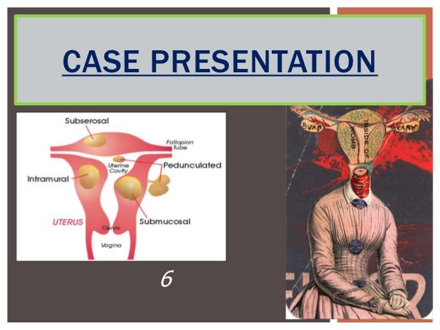 Myoma uteri presentation