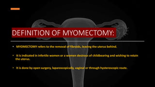 MYOMECTOMY AND OTHER CONSERVATIVE SURGERY.pptx