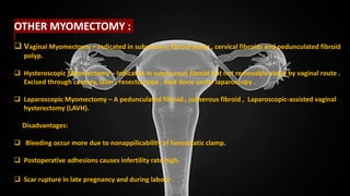 MYOMECTOMY AND OTHER CONSERVATIVE SURGERY.pptx