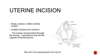 Myomectomy sneha | PPTX