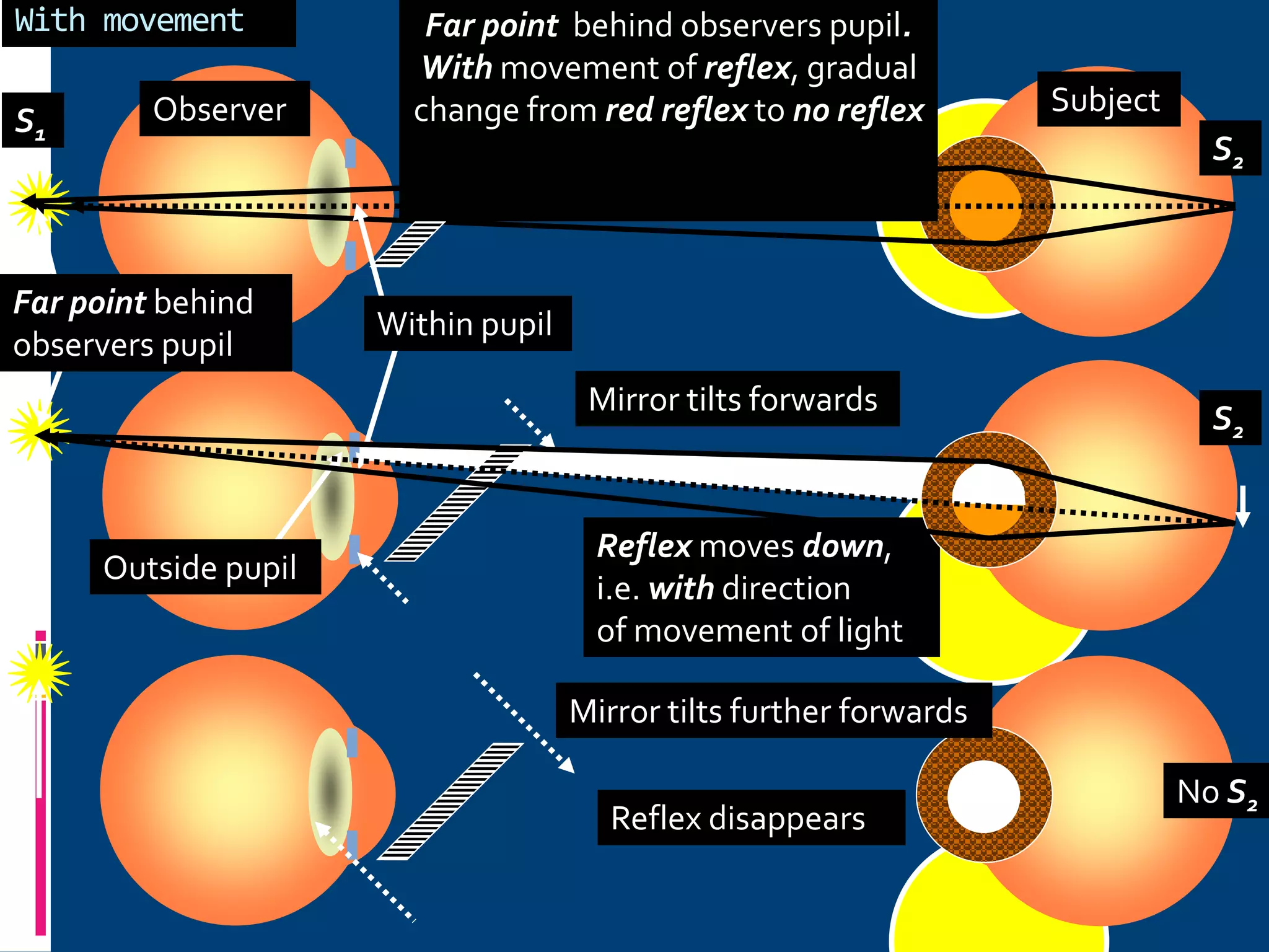 Retinoscopy | PPTX