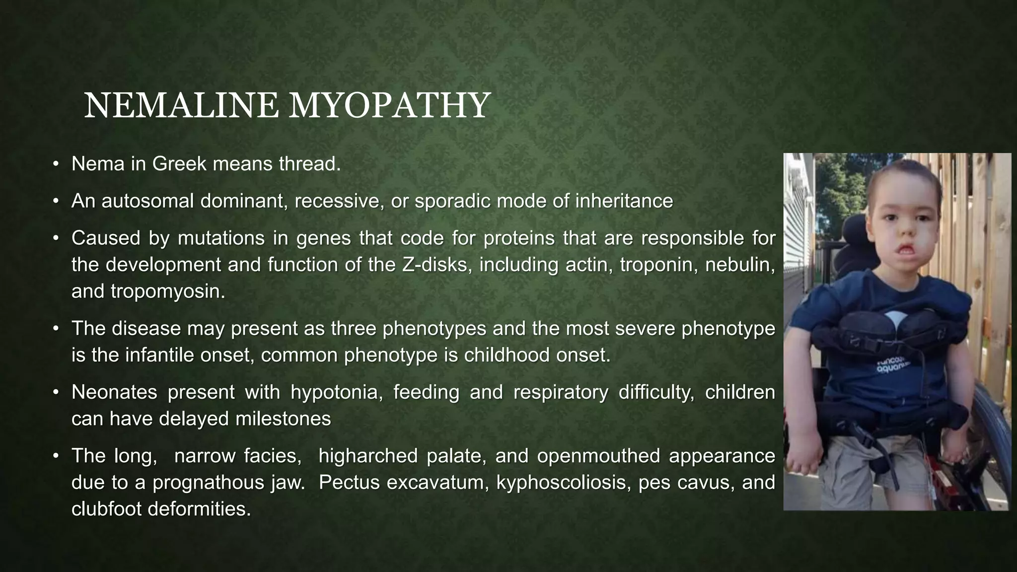 Myopathies | PPTX