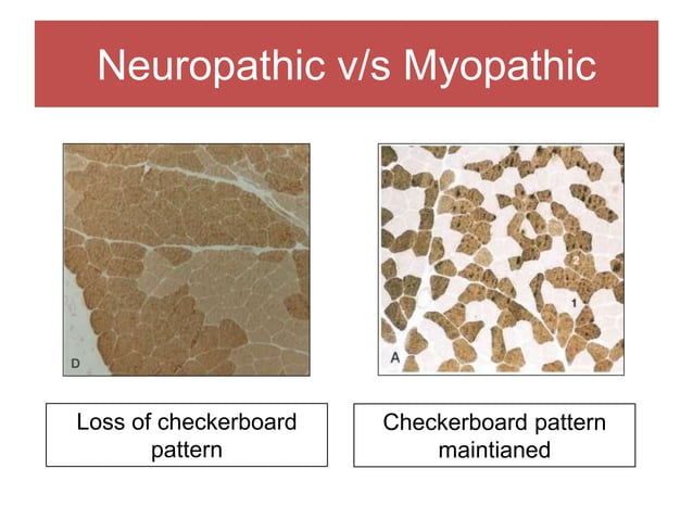 Myopathies | PPT