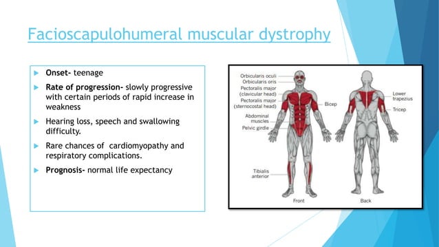 Myopathies Classification and physiotherapy management.pptx | Physical ...