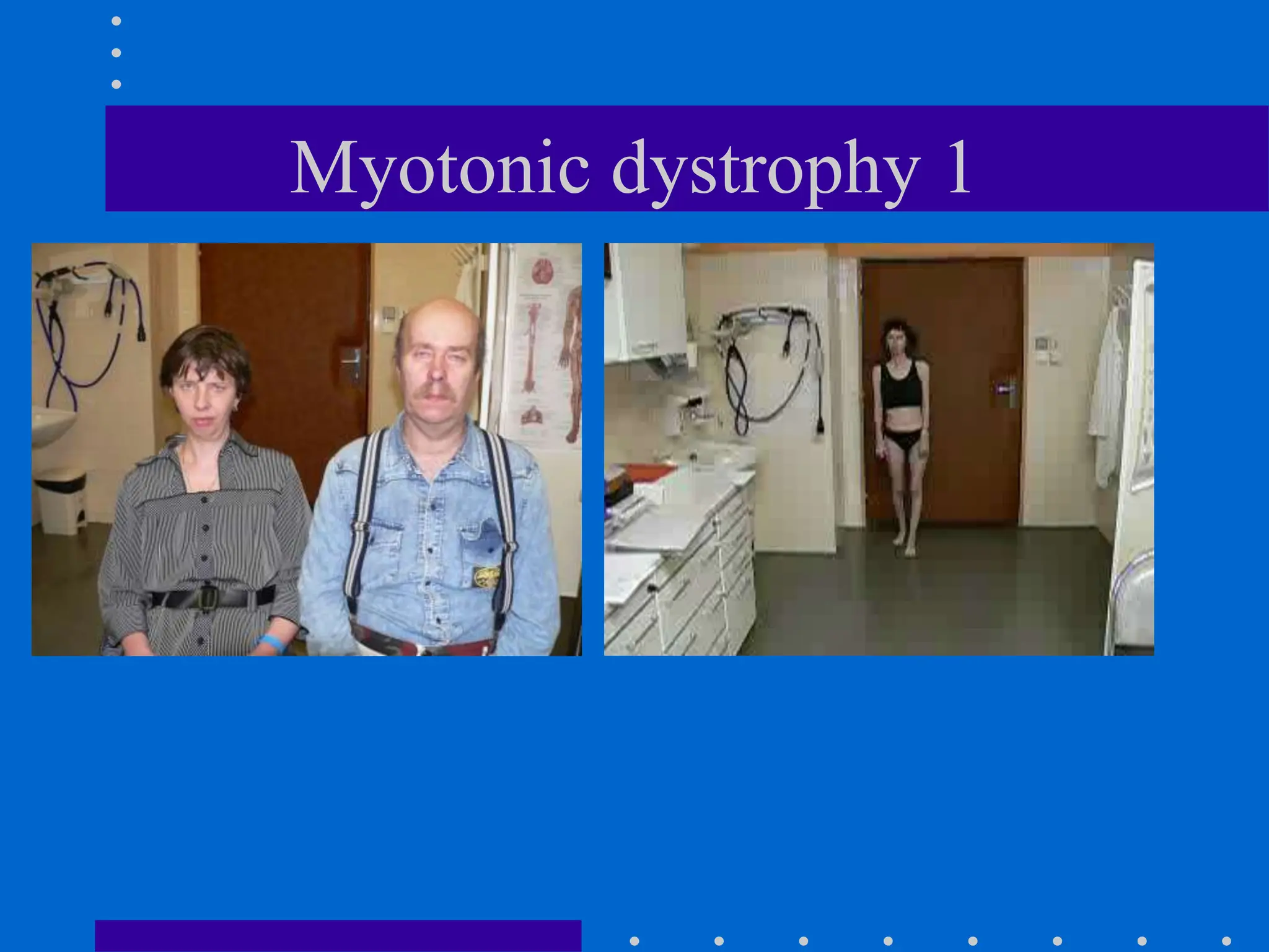 myopathies...........................ppt