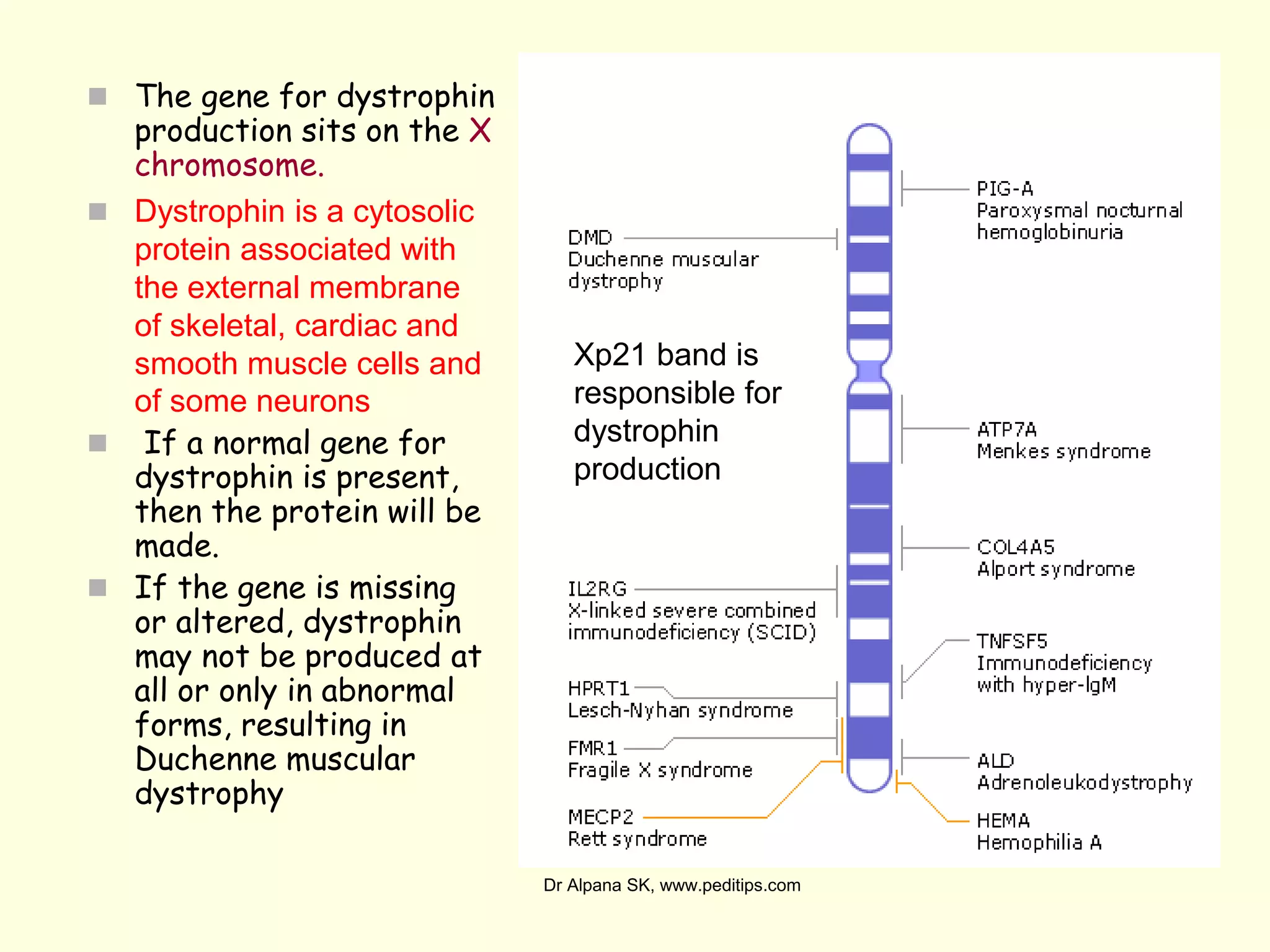 Muscular Dystrophies in Childhood | PPTX