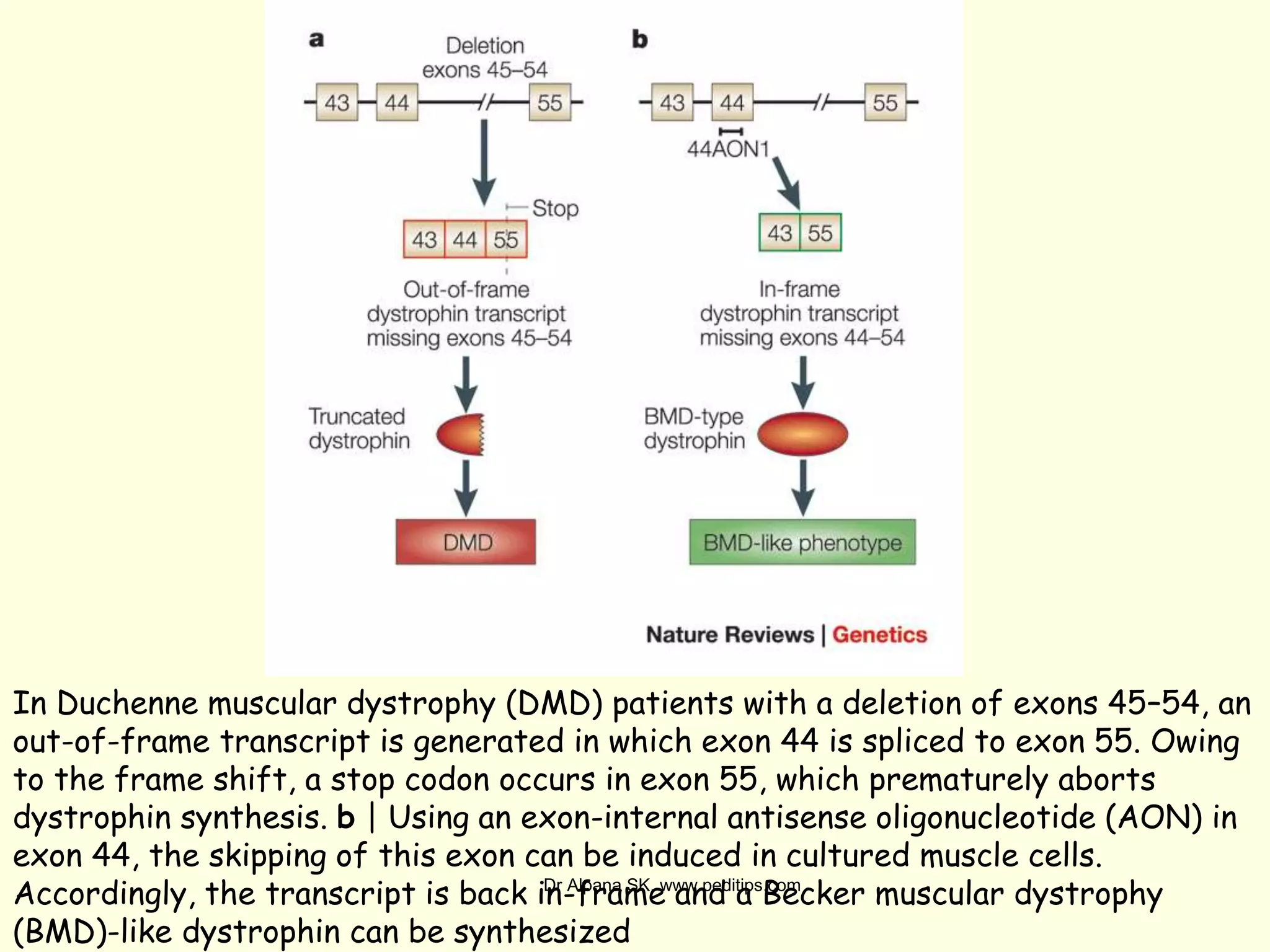 Muscular Dystrophies in Childhood | PPTX