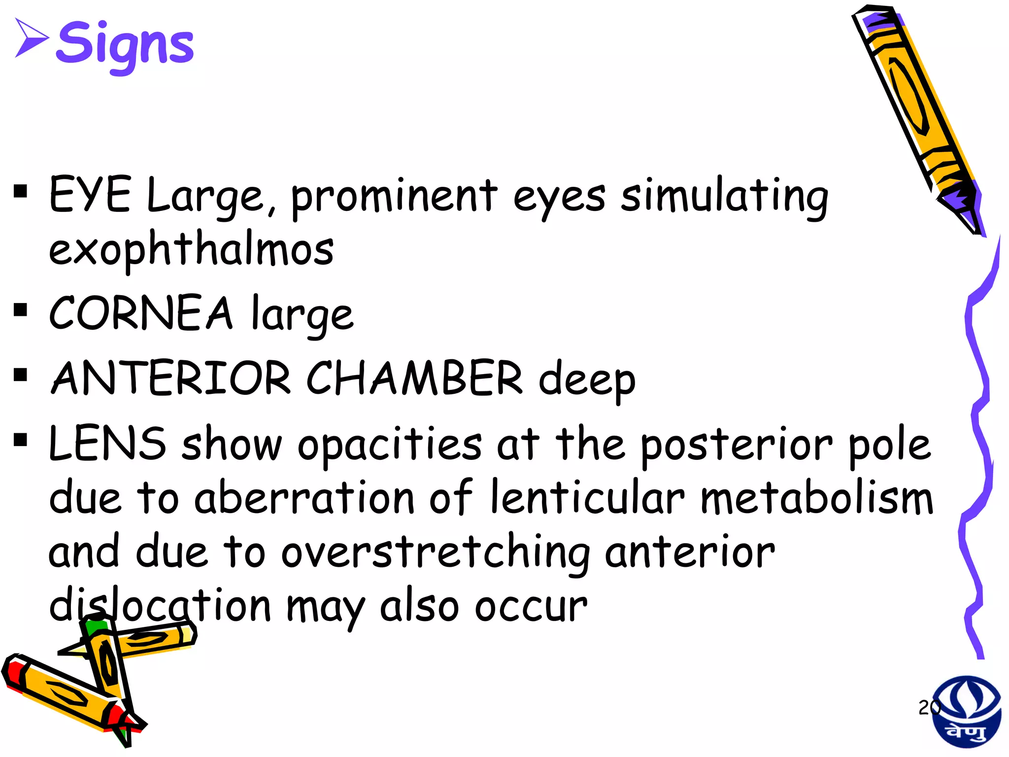 Myopia | PPT