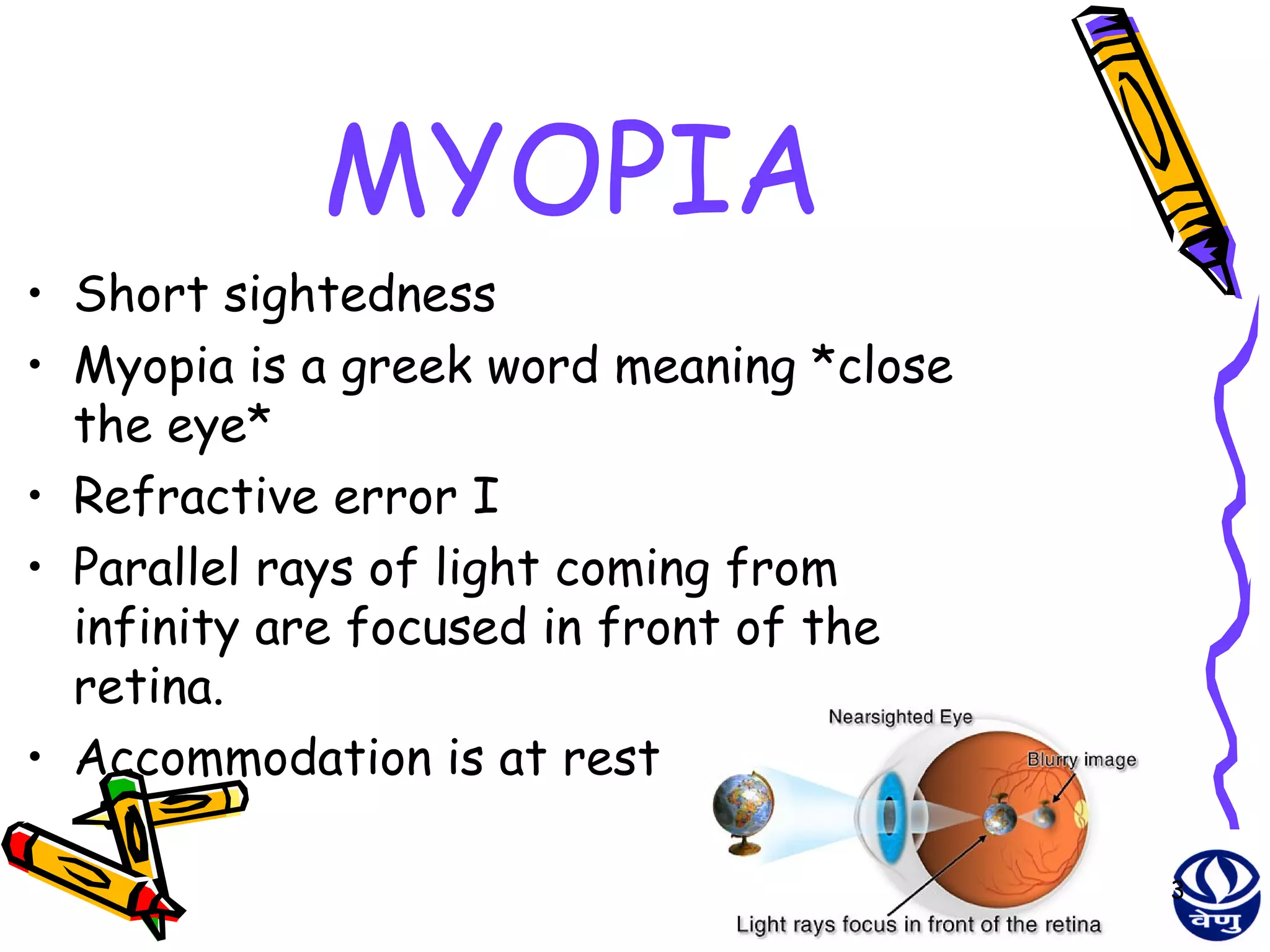 Myopia | PPT