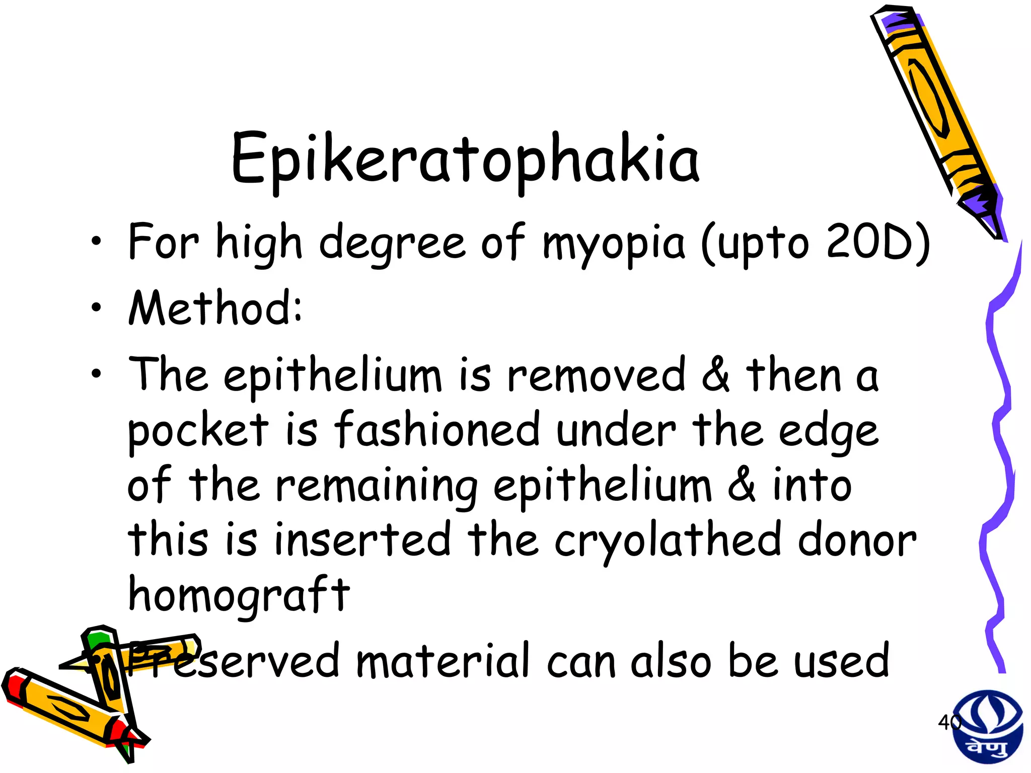 Myopia | PPT