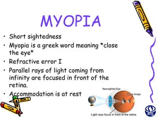 Myopia | PPT