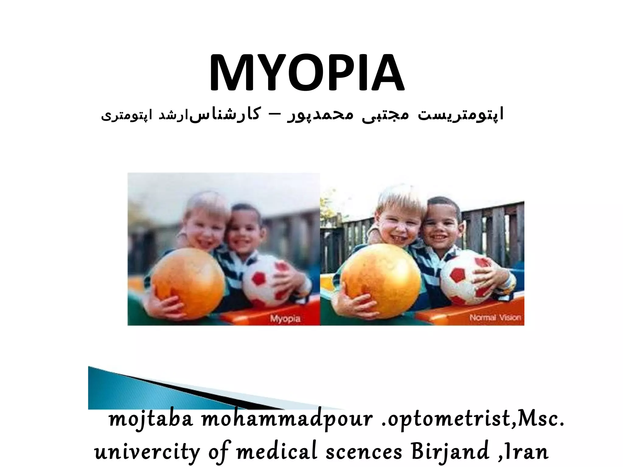 Myopia | PPT