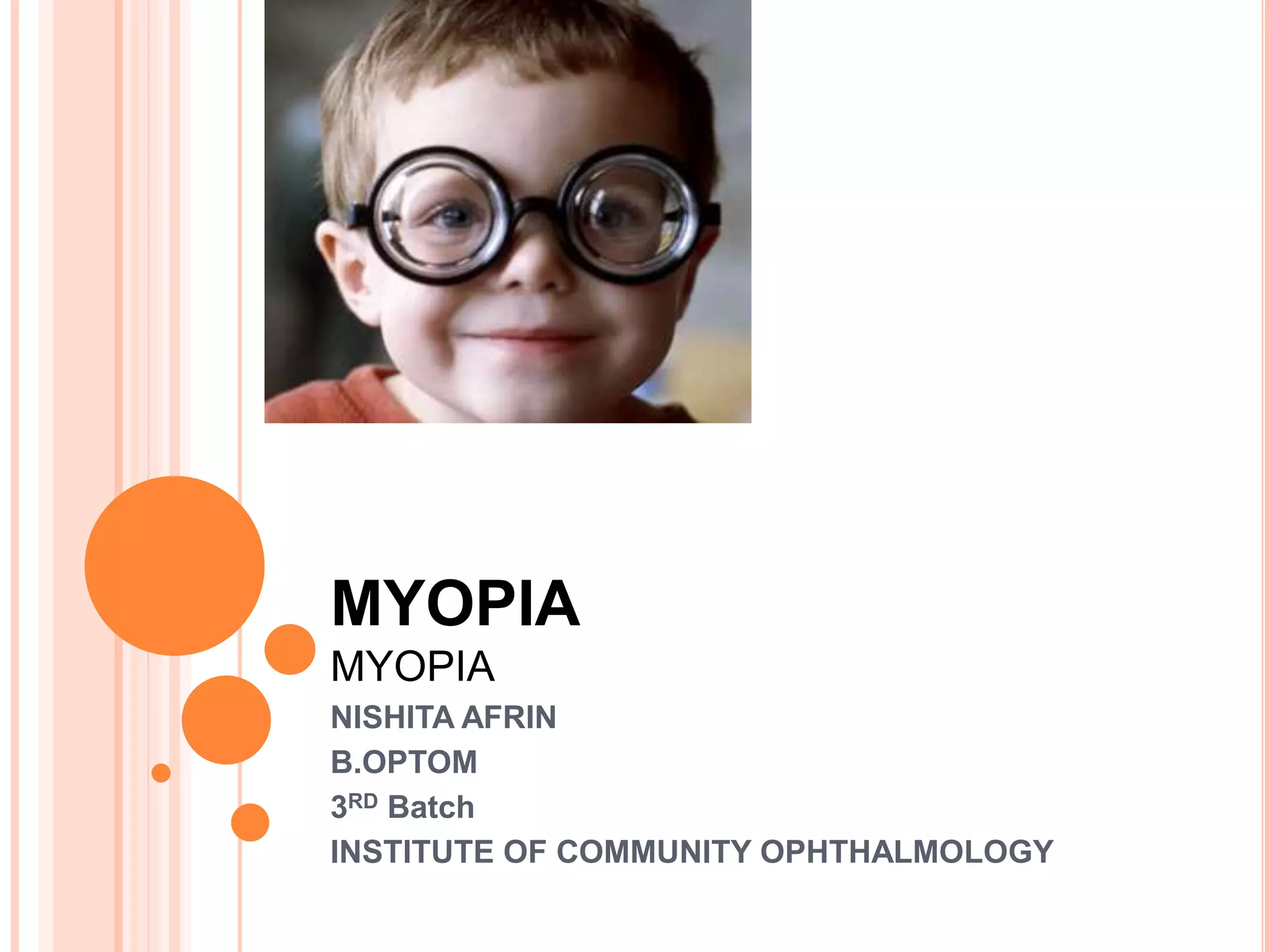 Myopia | PPTX