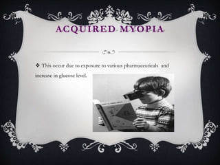 Myopia | PPT