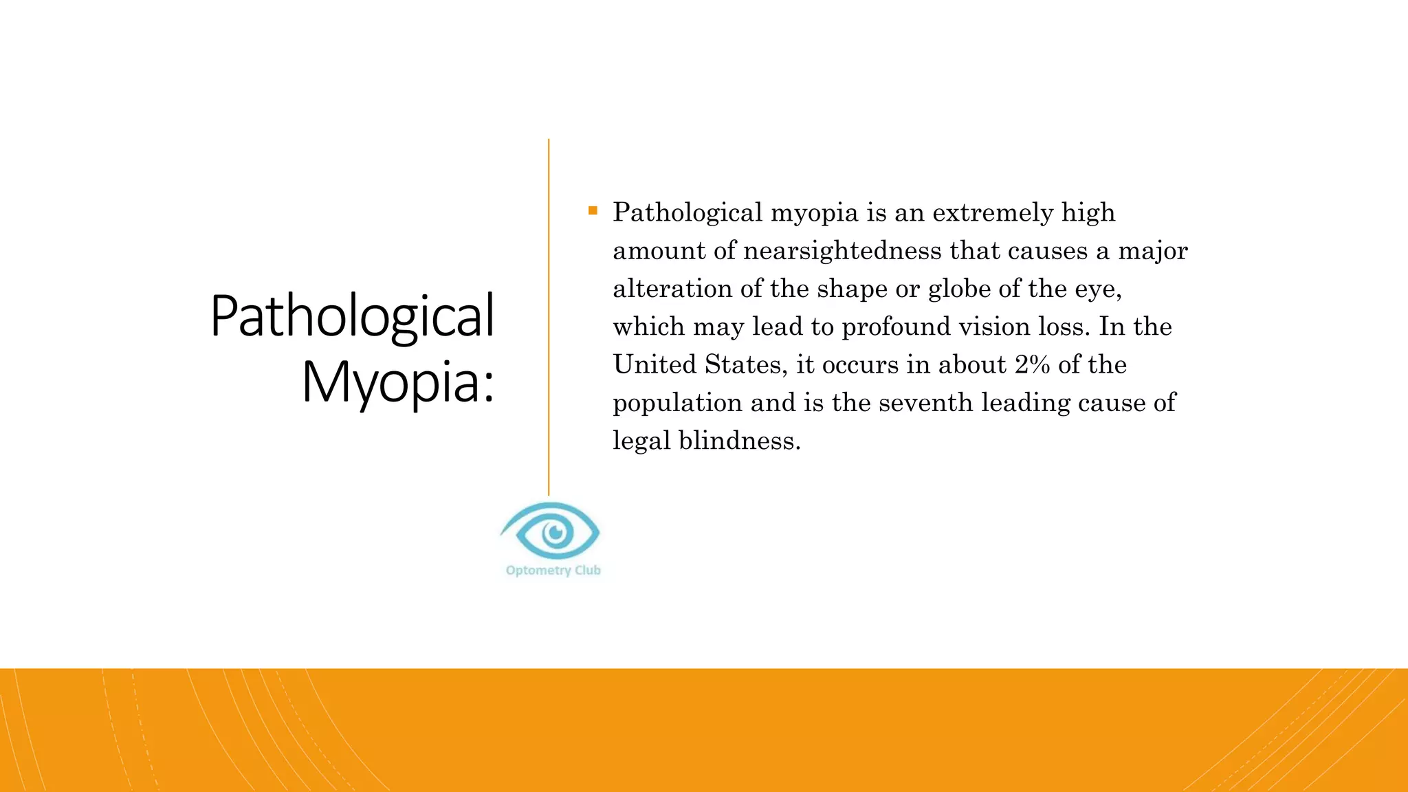 Myopia classification and management by Tahir Shaukat | PPTX