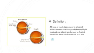 Myopia classification and management by Tahir Shaukat | PPTX