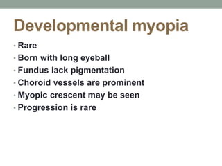 Myopia Ophthalmology ( Quick Review ) | PPT