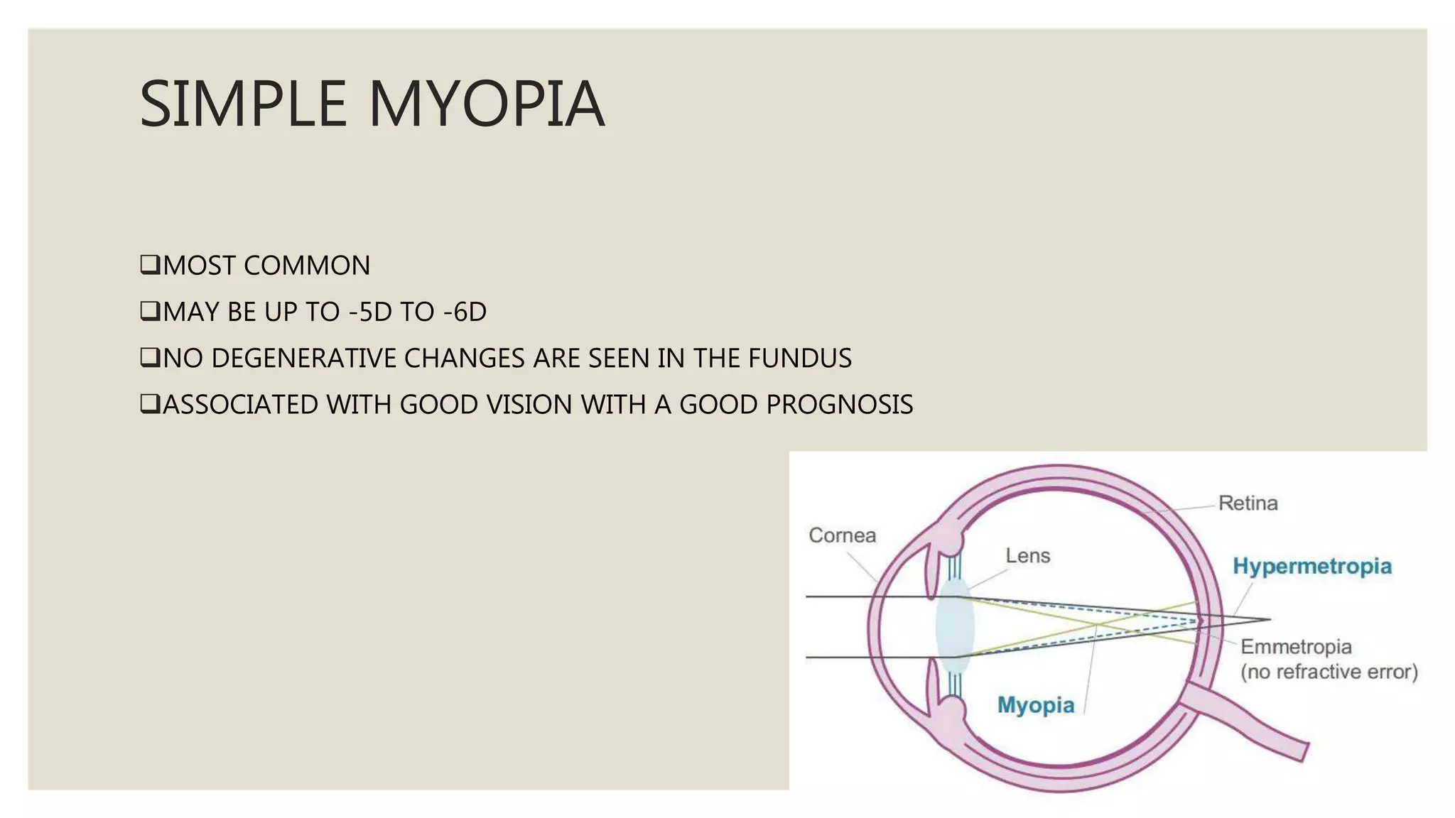 Myopia | PPT