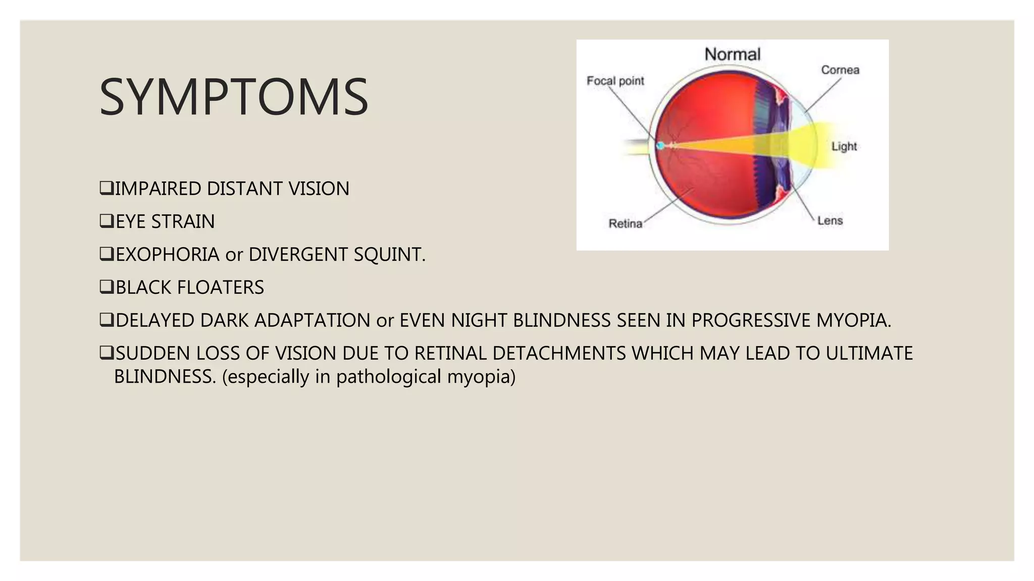 Myopia | PPTX