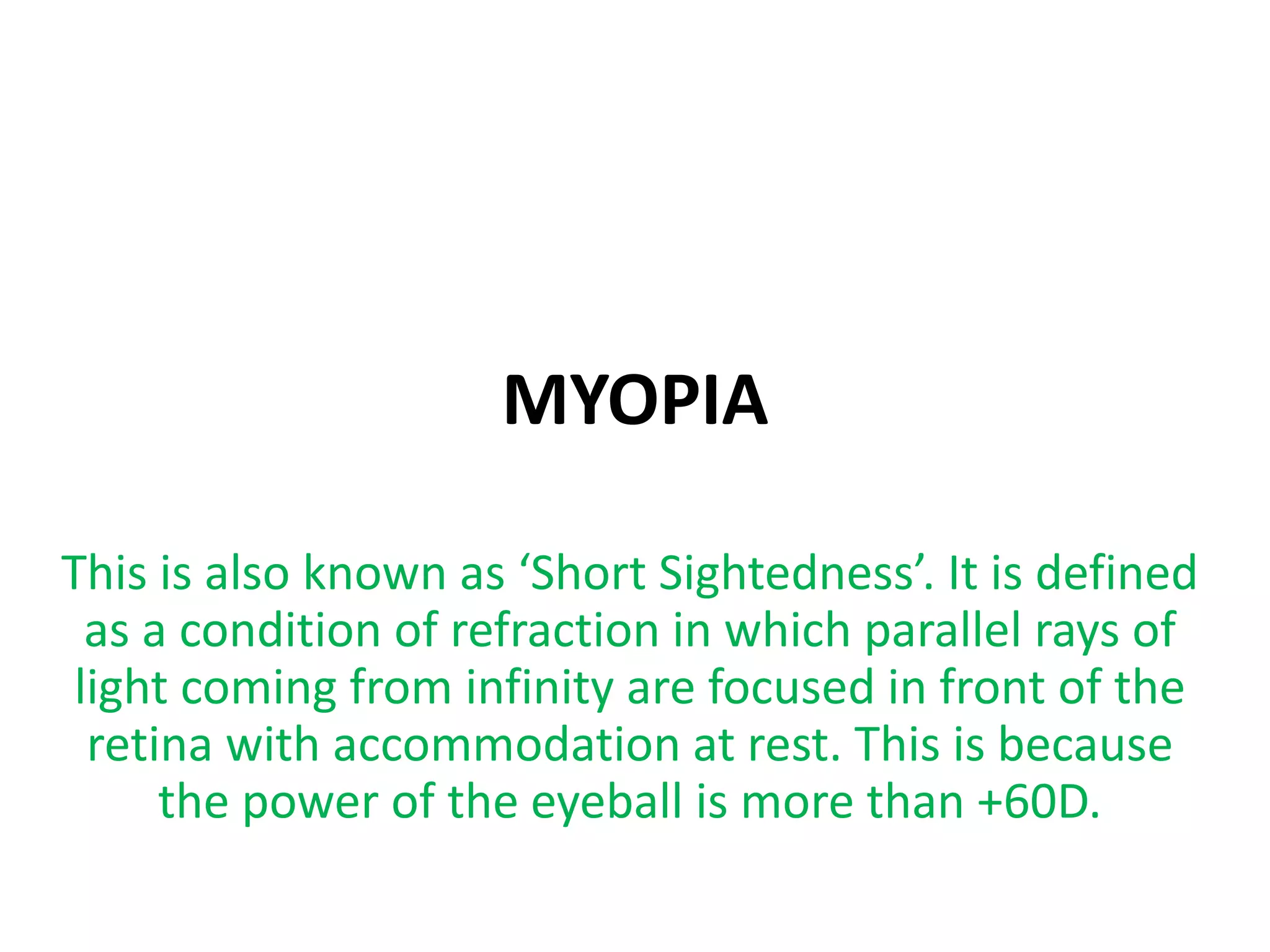 Myopia | PPTX