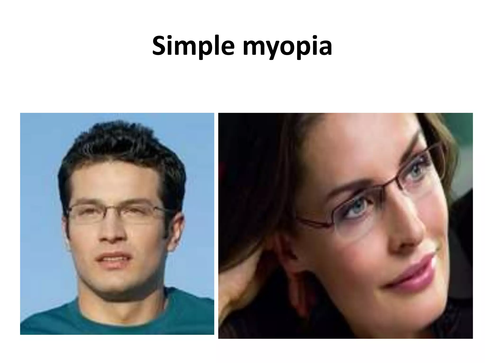 myopia.pptx