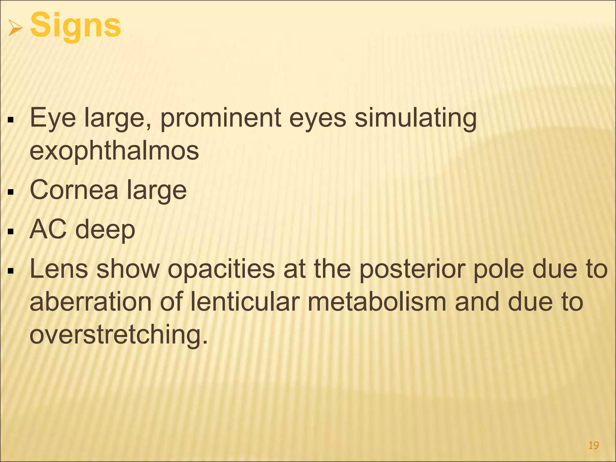 myopia.ppt