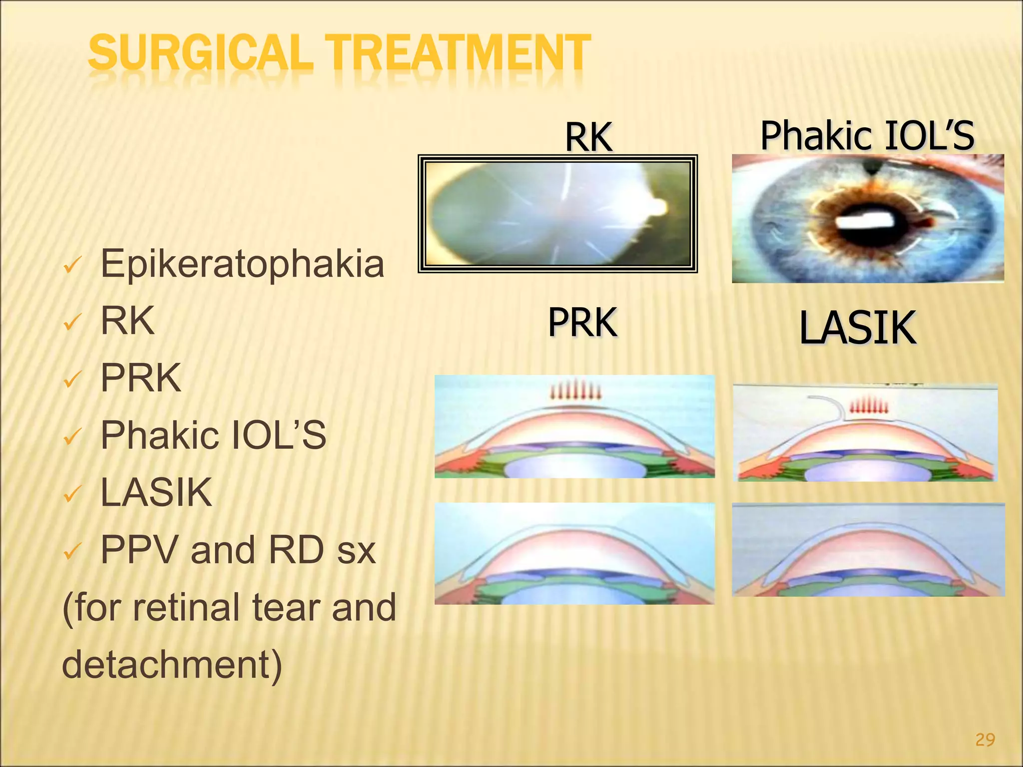 myopia.ppt