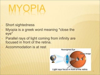 myopia.ppt