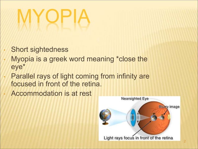 myopia.ppt | Eye and Vision Conditions | Diseases and Conditions
