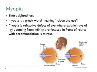 Myopia.pdf