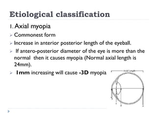 Myopia.pdf