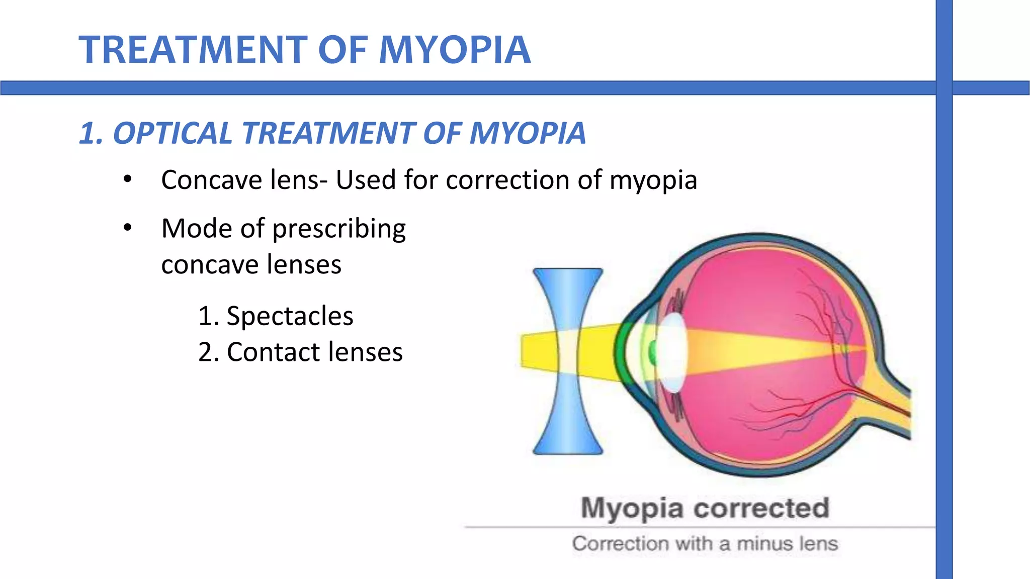 Myopia refractive error of eye | PPTX