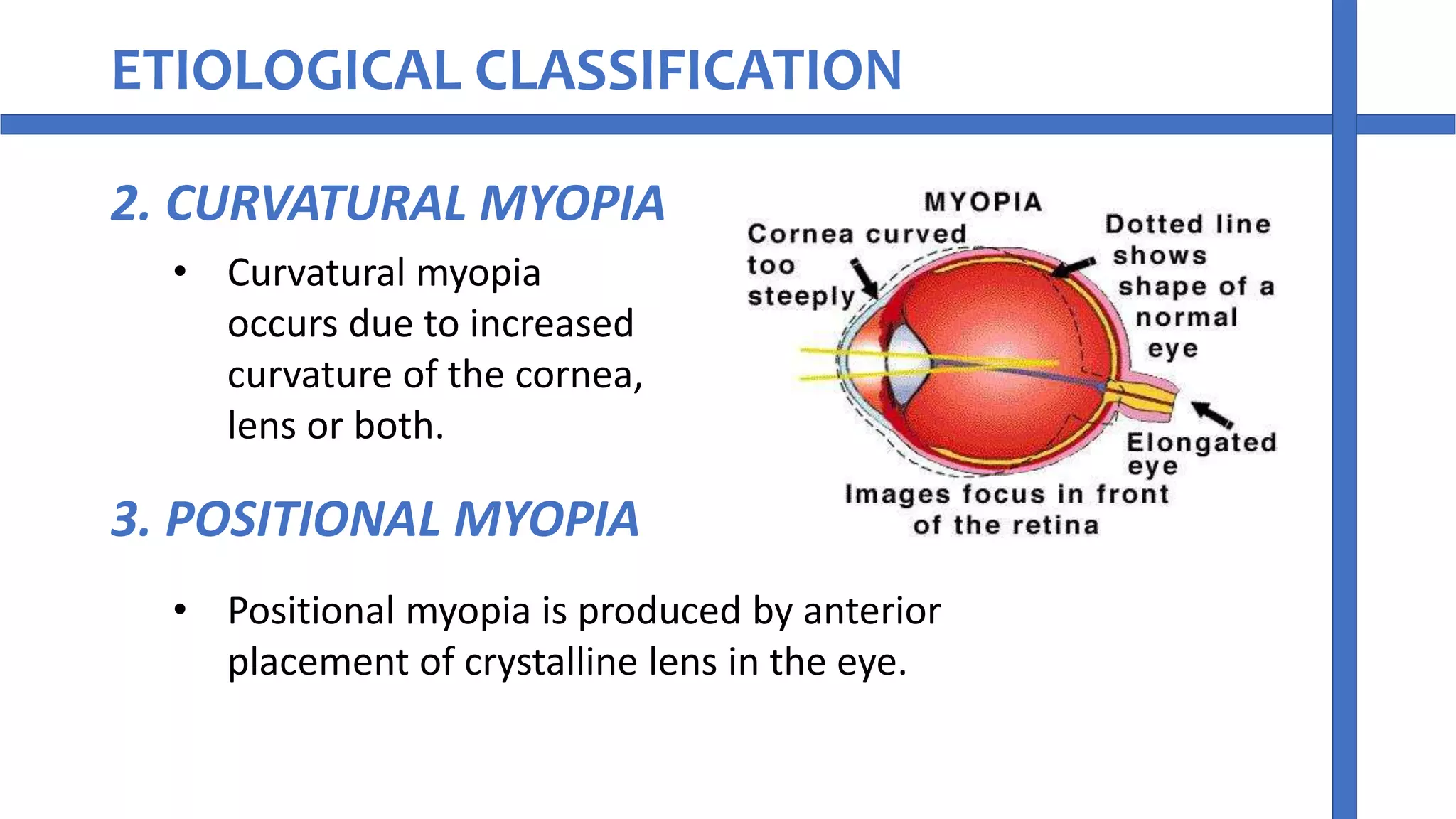 Myopia refractive error of eye | PPT | Free Download