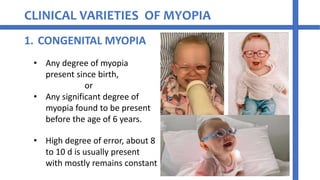 Myopia refractive error of eye | PPTX