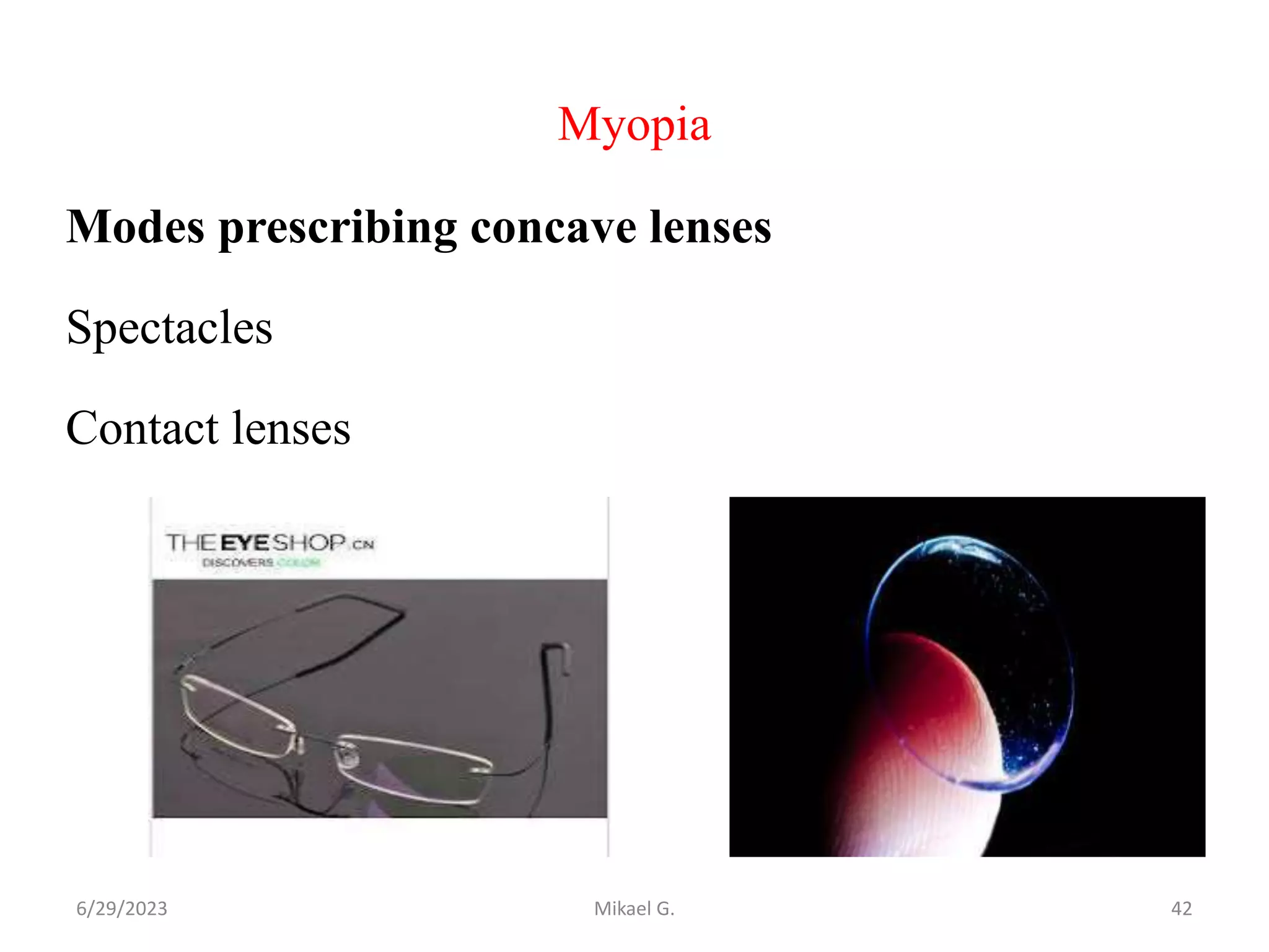 Myopia.pptx