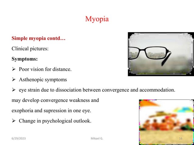 Myopia.pptx