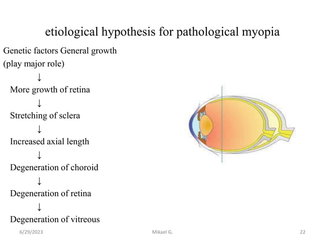 Myopia.pptx