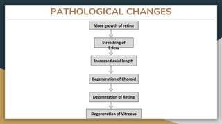 Patho Physiology of Myopia, Etiology and complications | PPT