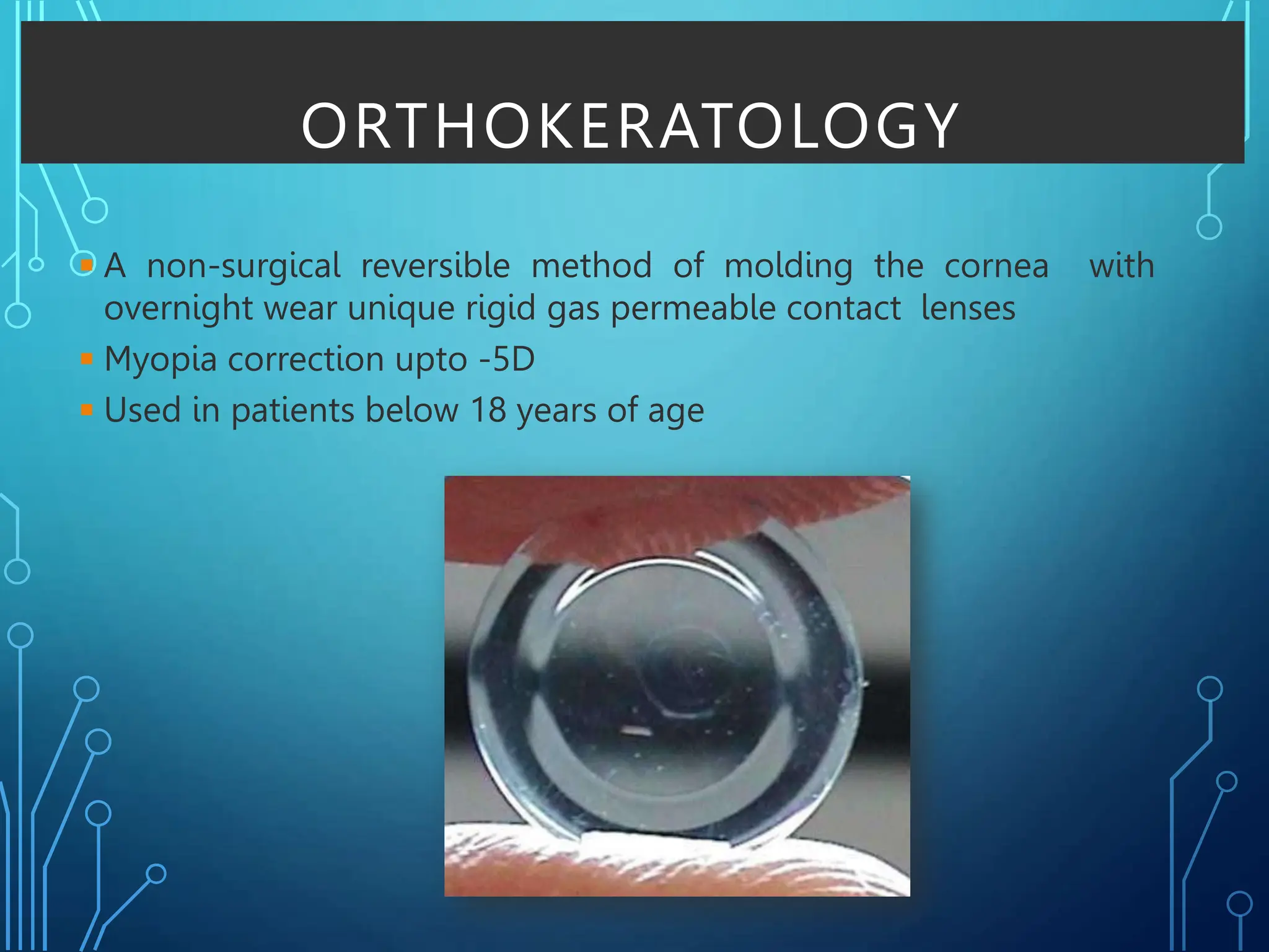 MYOPIA , basics , causes , types and treatment | PPTX