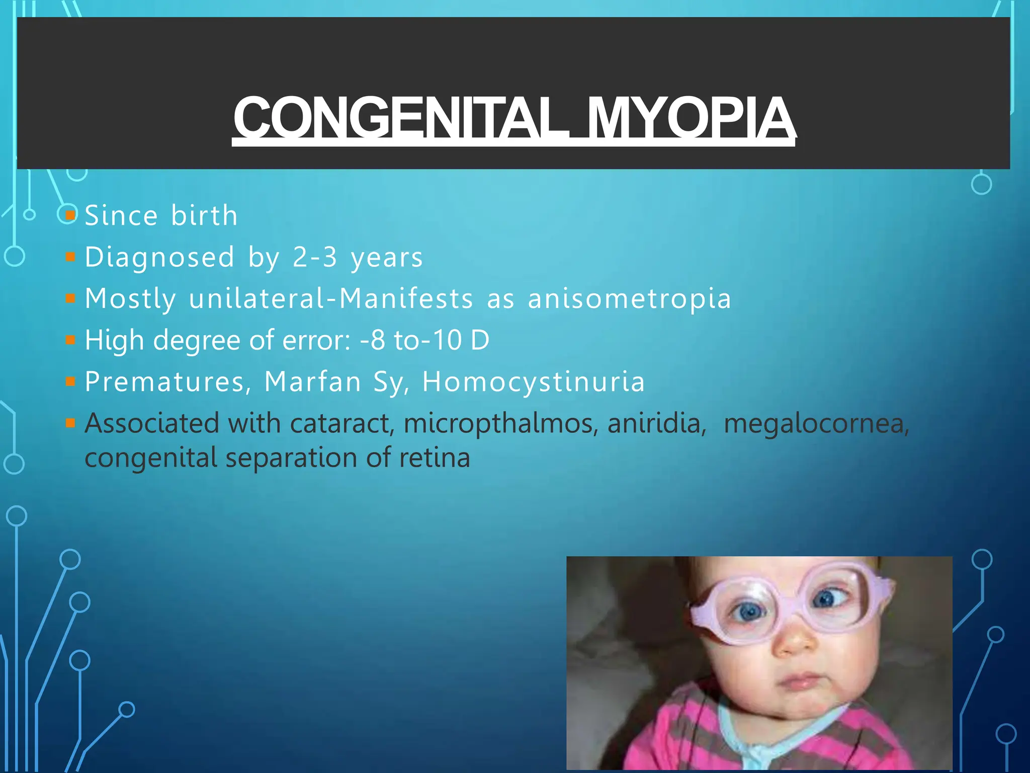 MYOPIA , basics , causes , types and treatment | PPTX