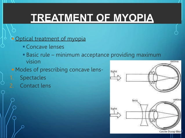 MYOPIA , basics , causes , types and treatment | PPTX