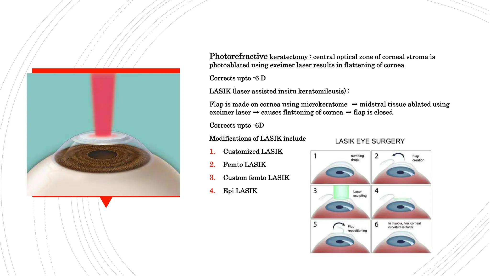 myopia of eye ophthalmology description.pptx