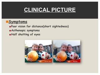 REFRACTIVE ERROR MYOPIA AND ITS MANAGEMENT.pptx